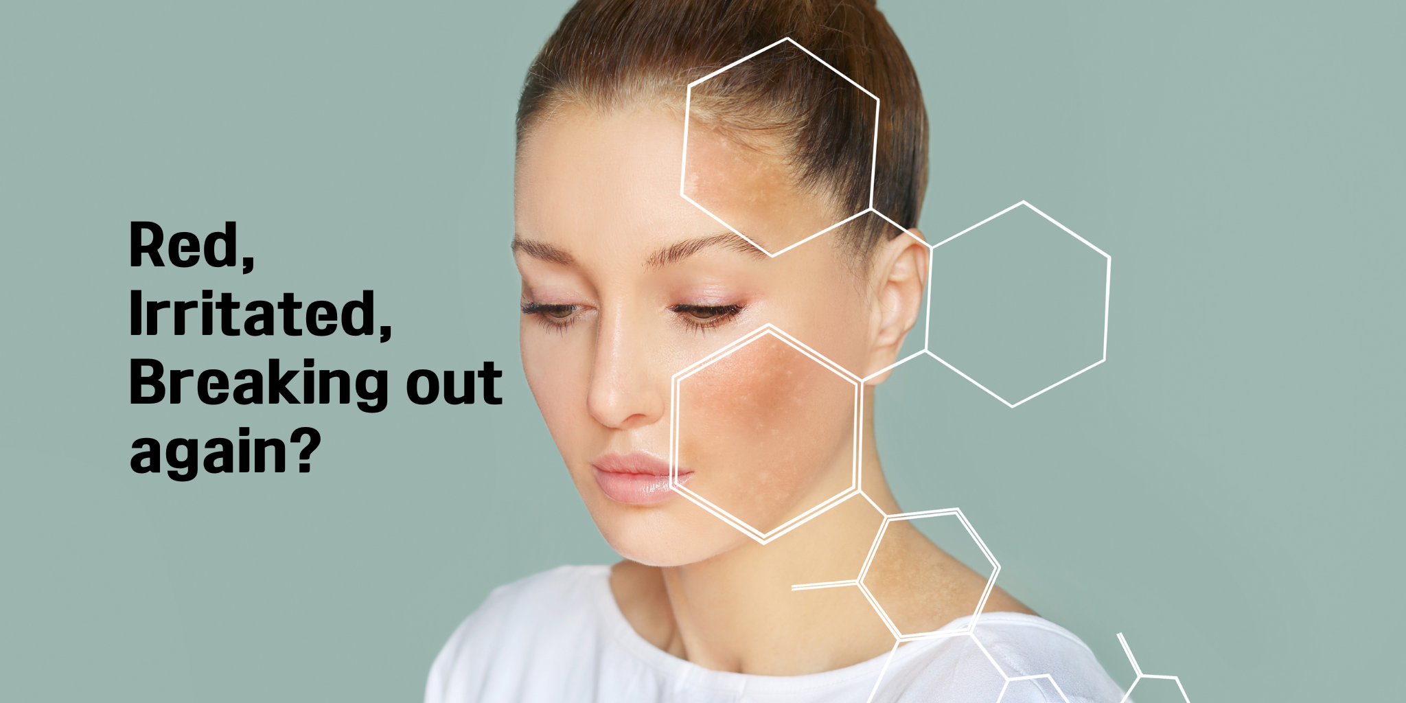 Redness, Flaking, Breakouts? You Might Have a Damaged Skin Barrier